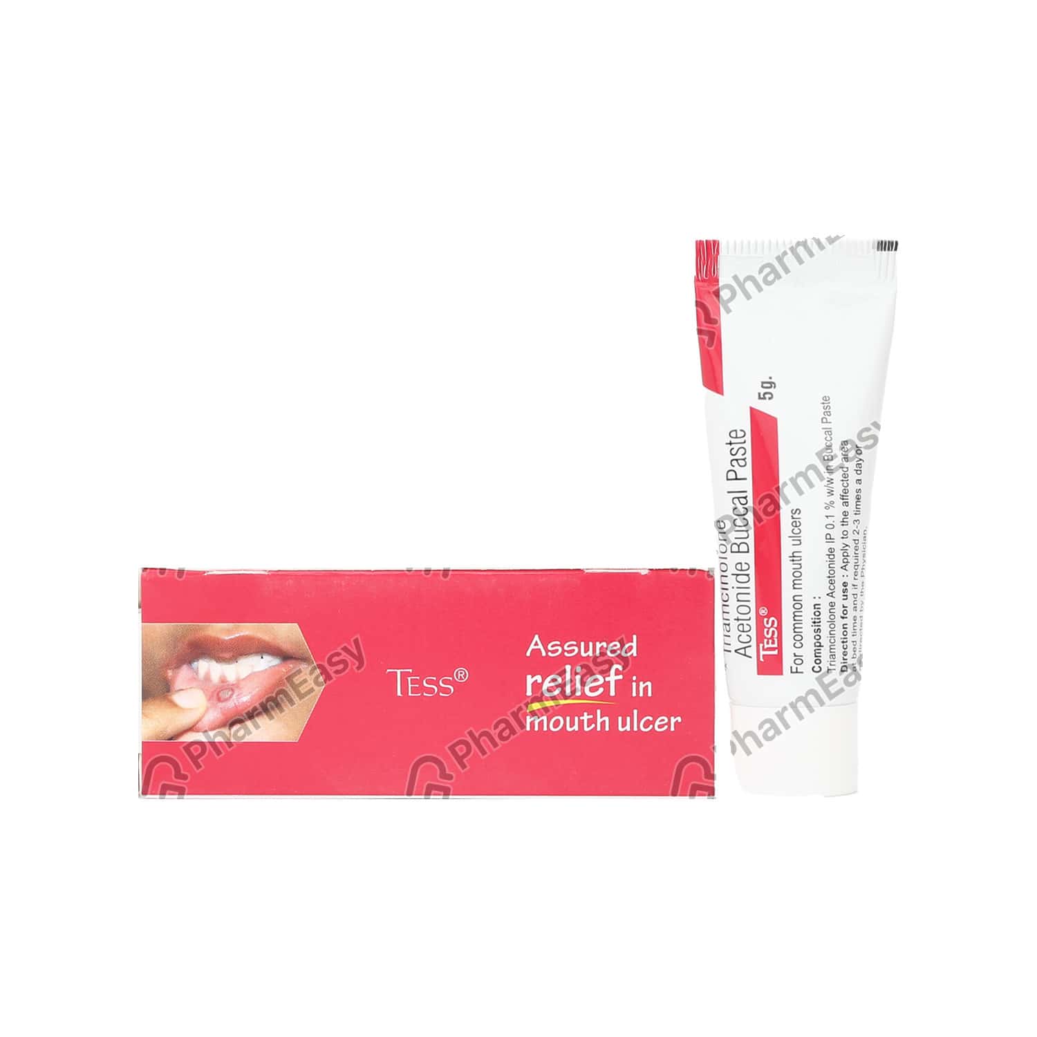 Buy Tess 0.1 % Oral Paste For Local Application (5) Online at Flat 18% ...