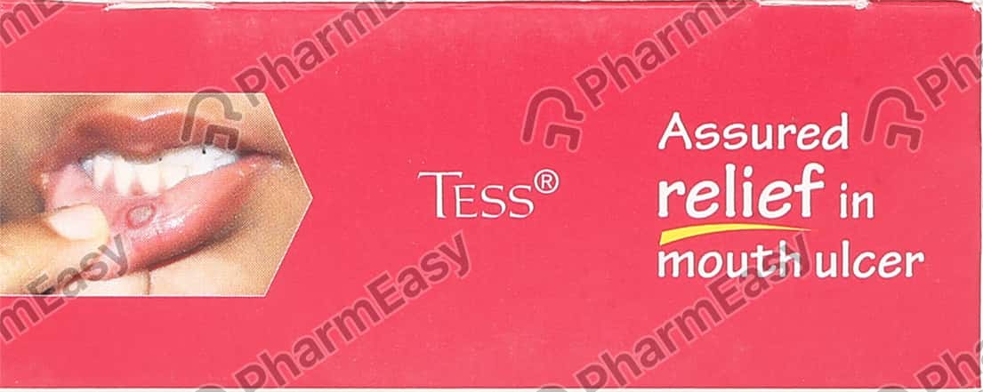 Buy Tess 0.1 %W/W Mouth Paste (5) Online & Save Up to 24% at PharmEasy