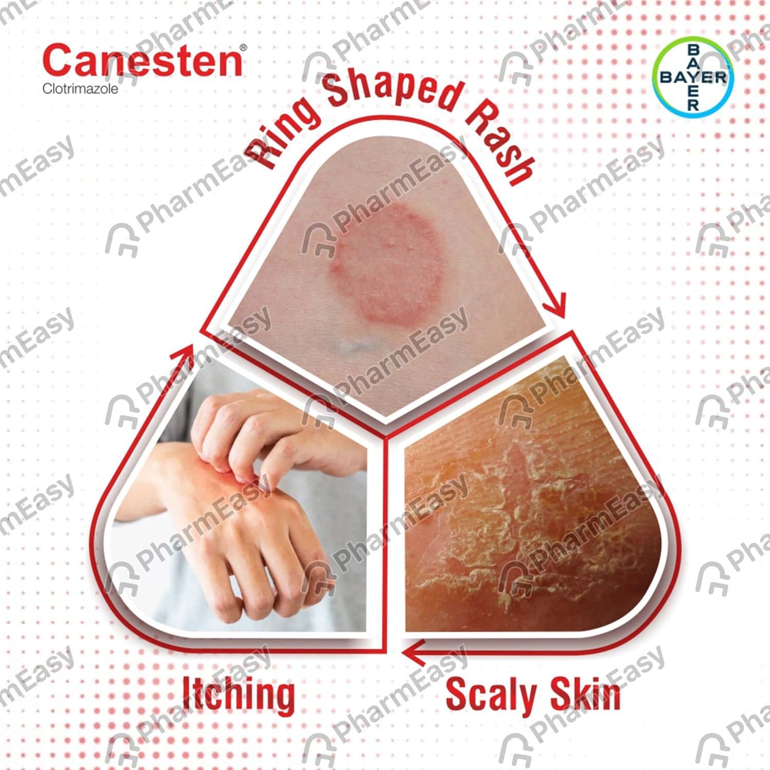 Canesten 10 MG Skin Solution (30): Uses, Side Effects, Price & Dosage ...