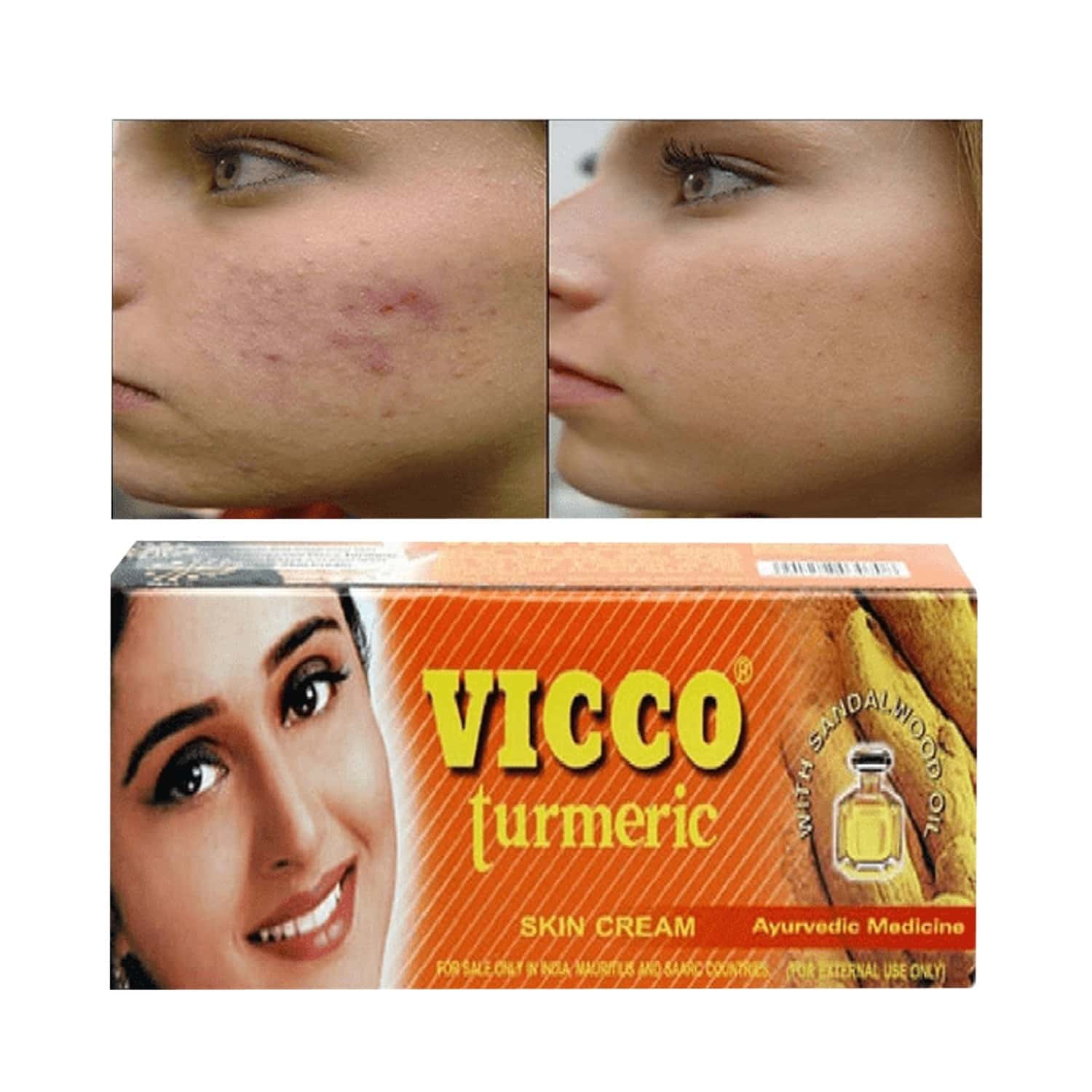 Buy VICCO TURMARIC CREAM 15GM Online & Get Upto 60% OFF at PharmEasy