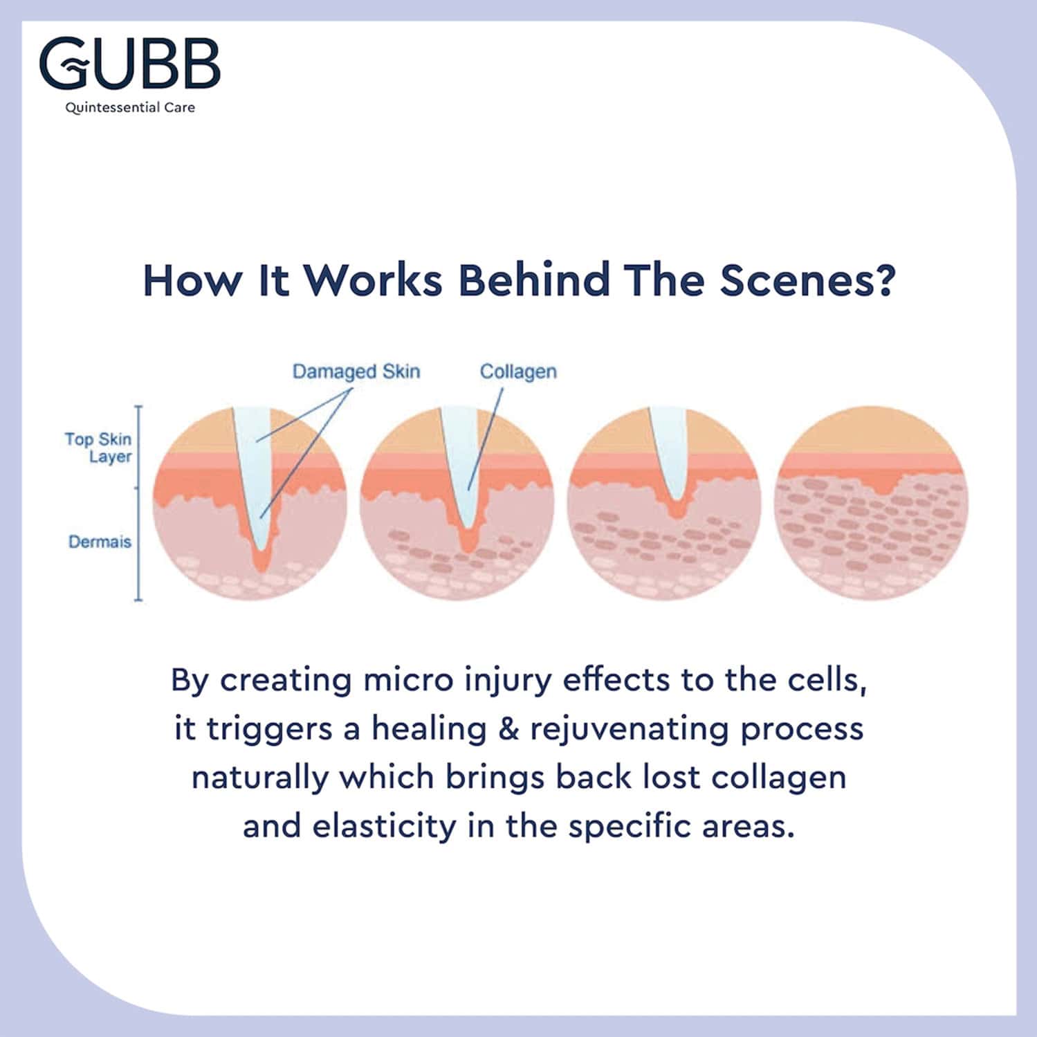 Buy GUBB DERMA ROLLER 0.5MM FOR HAIR REGROWTH FACE ACNE SCARS & SKIN ...