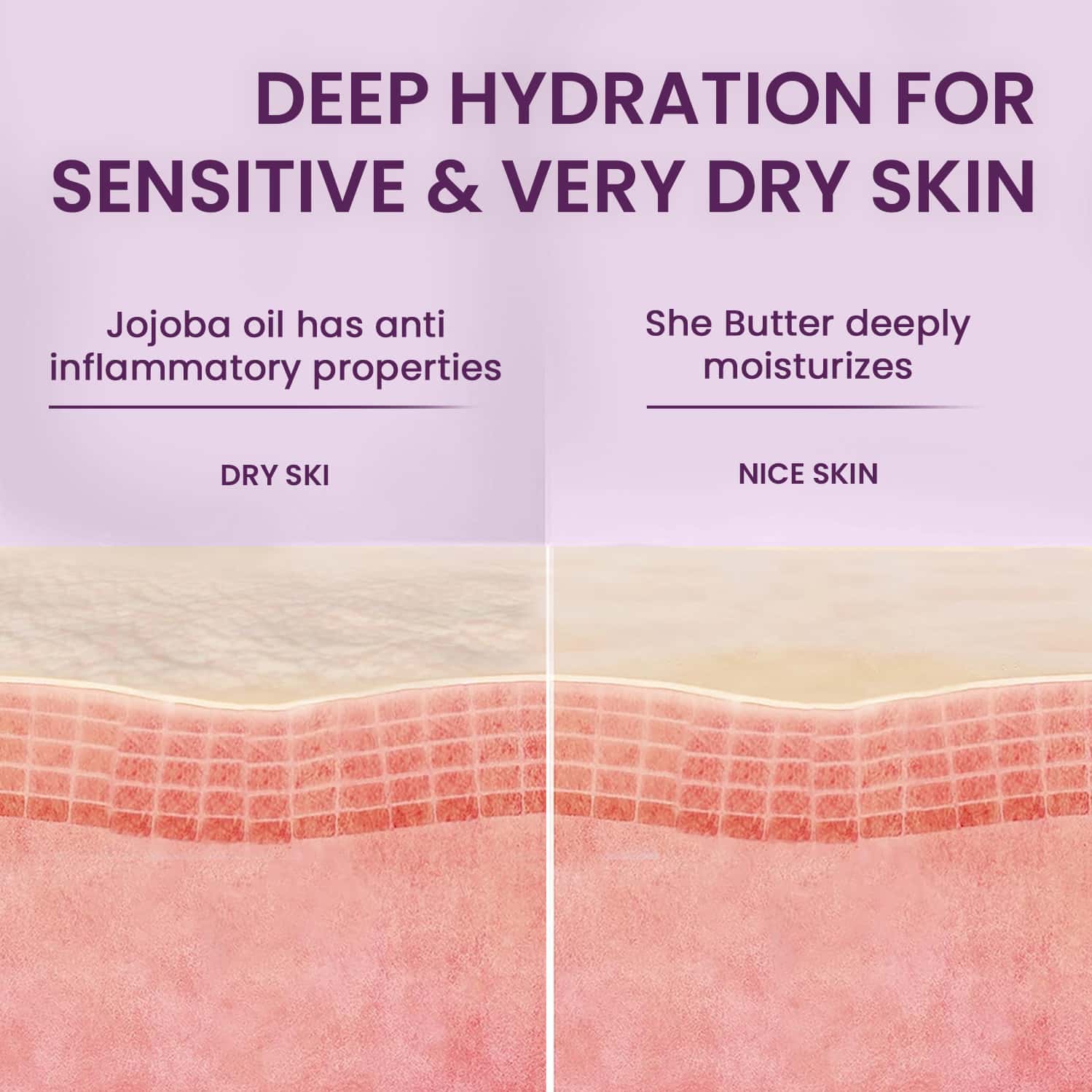 Buy THE SKIN STORY INTENSE RELIEF THERAPY CREAM, 45G Online & Get Upto ...