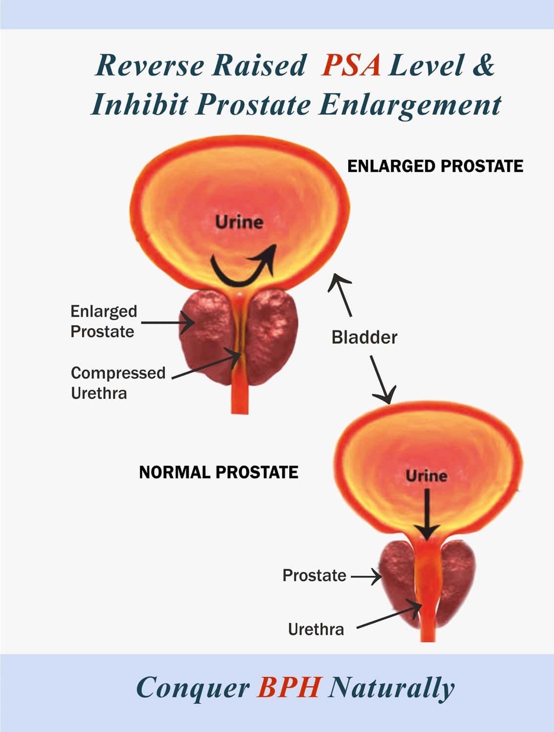 Buy PROSTOWIN CAPSULE - INHIBITS PROSTATE ENLARGEMENT - 3 X 10 Online ...