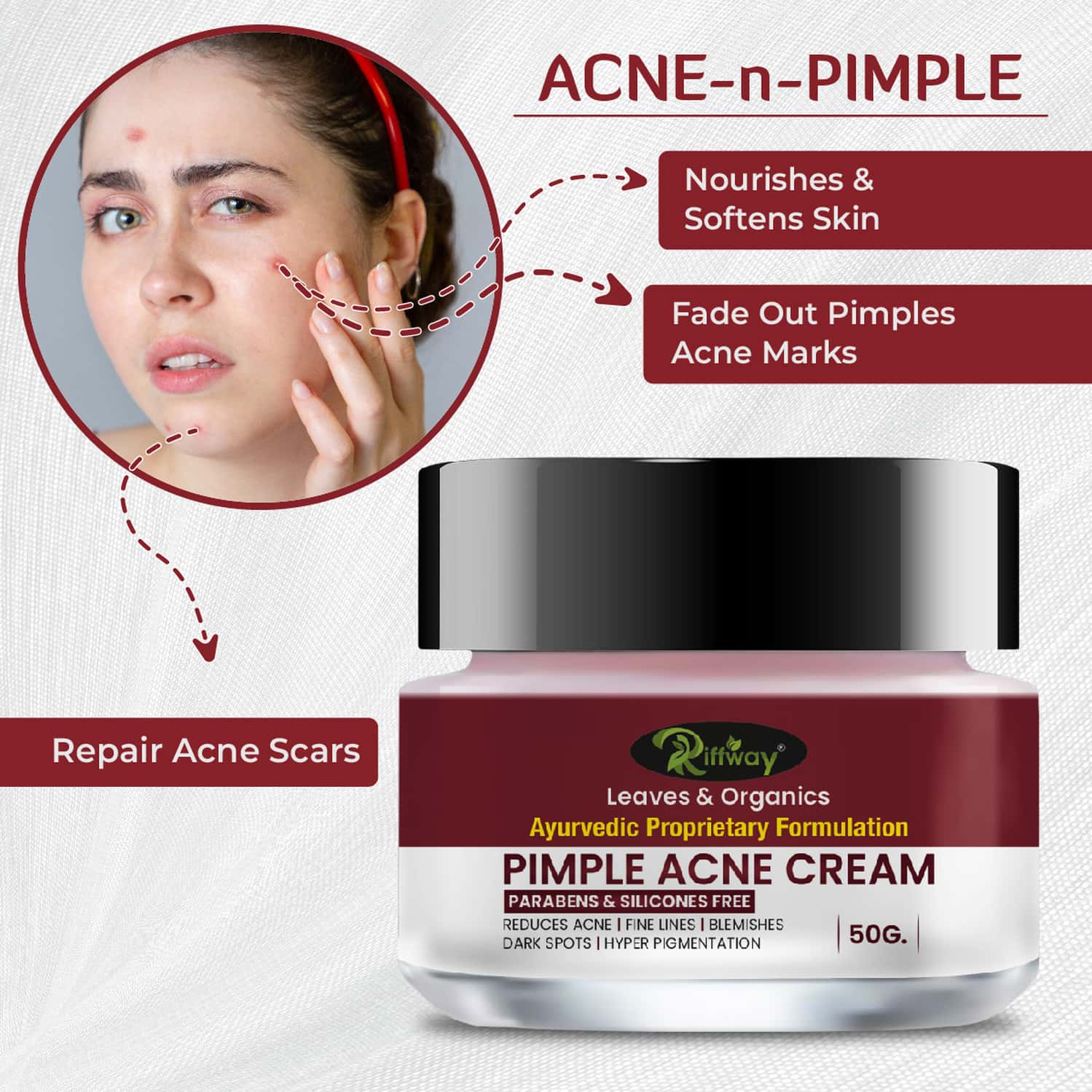 Buy PIMPLE ACNE HERBAL CREAM FOR PIMPLES AND DARK SPOTS, PURE AYURVEDIC ...