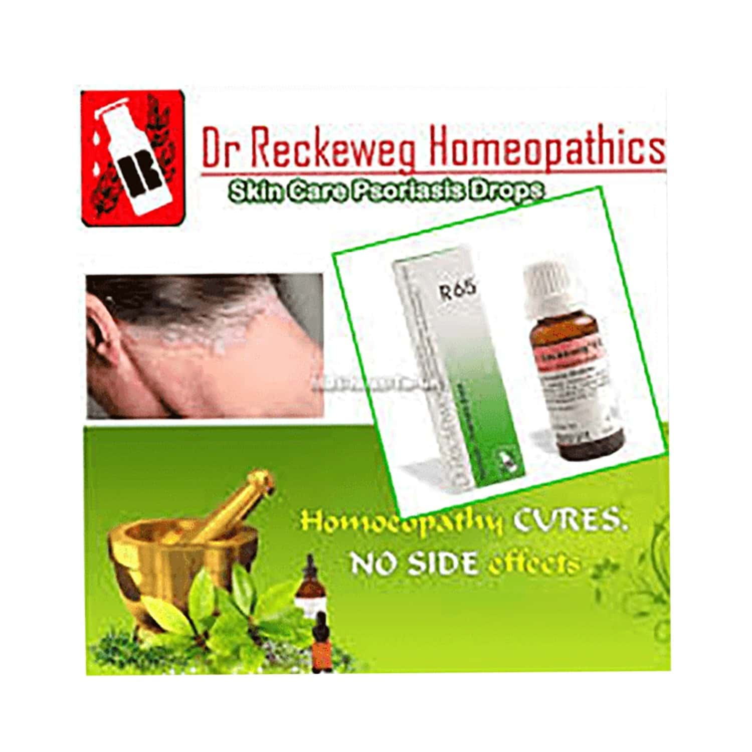 Buy DR.RECKEWEG R 65 PSORIASIS DROPS 22 ML Online & Get Upto 60% OFF at ...