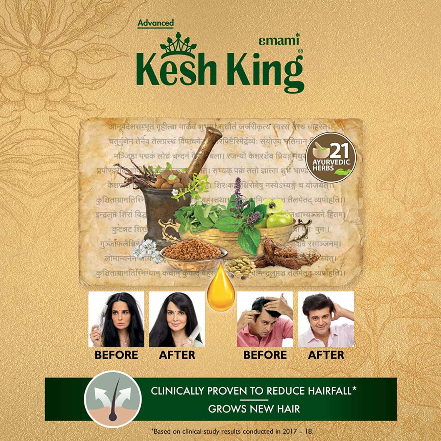 Buy KESH KING AYURVEDIC ANTI HAIRFALL HAIR OIL|21 NATURAL INGREDIENTS - 300 ML Online & Get Upto ...