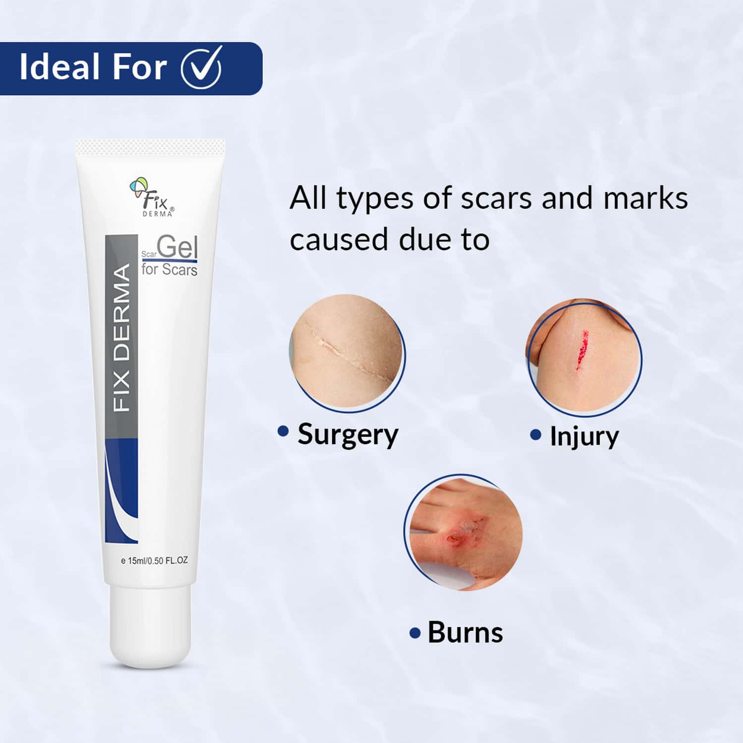 Buy FIXDERMA SCAR GEL, REDUCES ACNE SCARS, SURGERY SCARS, INJURY SCARS ...