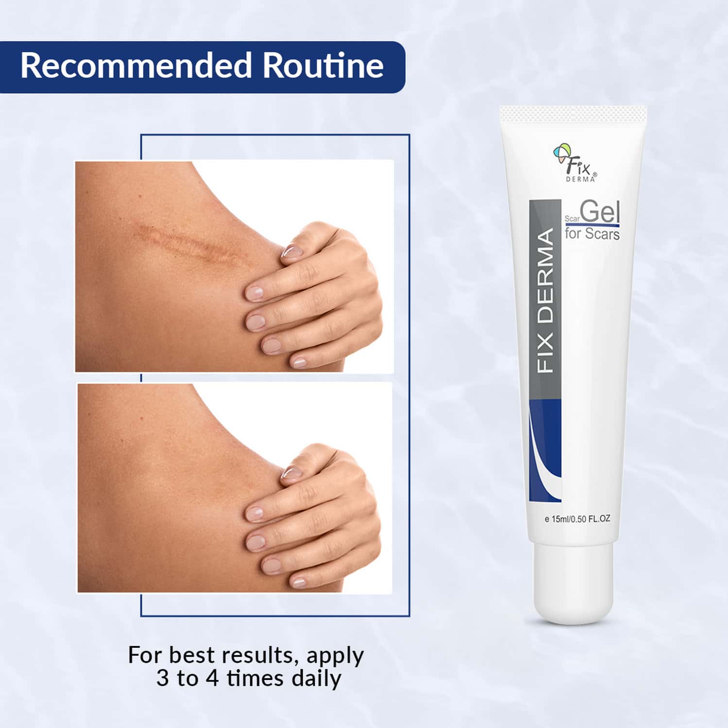 Buy FIXDERMA SCAR GEL, REDUCES ACNE SCARS, SURGERY SCARS, INJURY SCARS ...