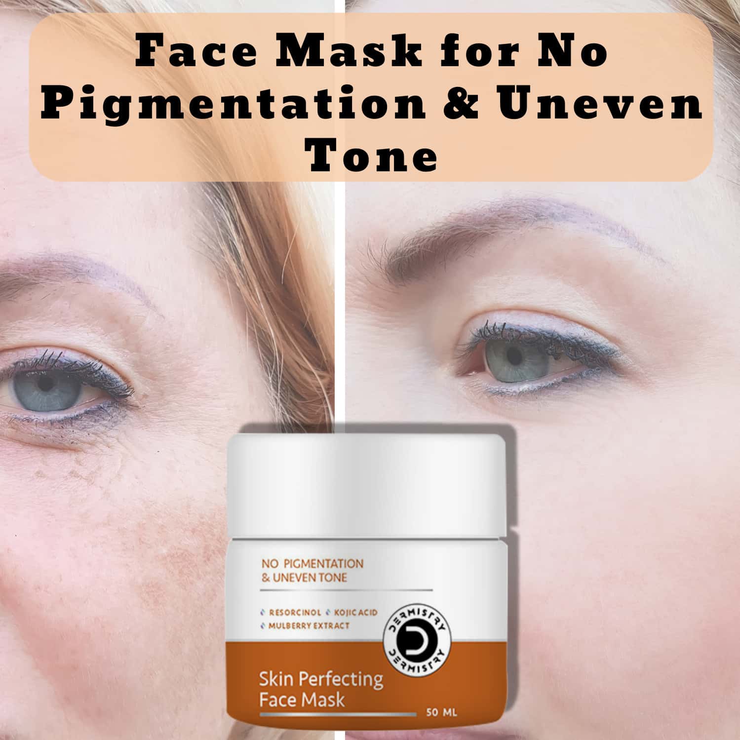 Buy DERMISTRY ANTI PIGMENTATION BLEMISH DARK SPOTS UNEVEN TONE REMOVAL ...
