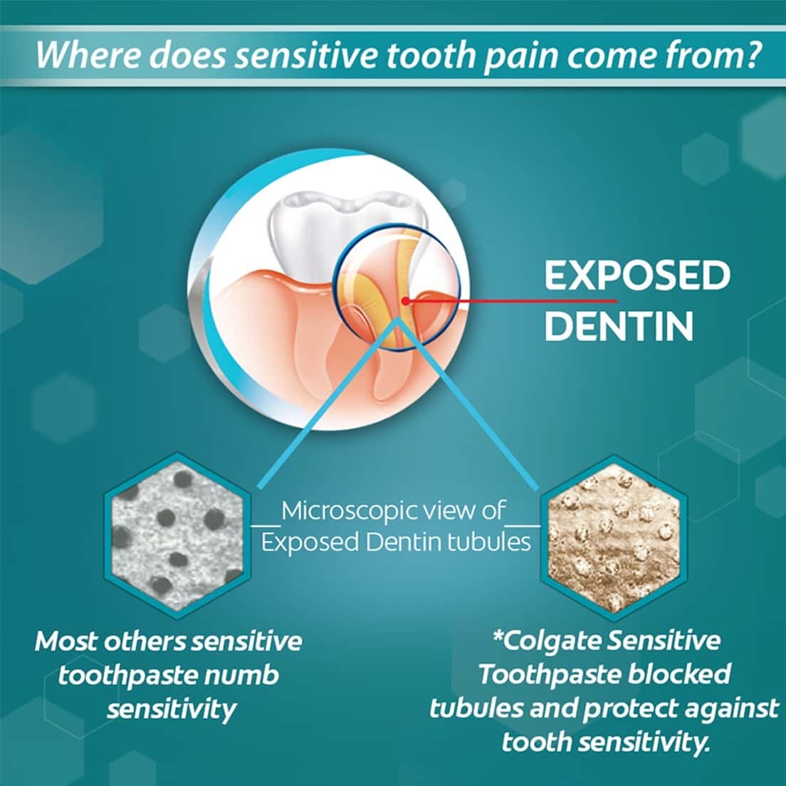 Buy COLGATE SENSITIVE PLUS TOOTHPASTE TUBE OF 30 G Online & Get Upto 60 ...