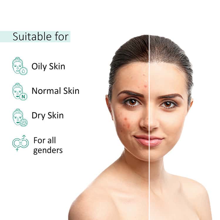 Buy DERMATOUCH BYE BYE ACNE SCARS & MARKS CREAM || ACNE SCARS CORRECTOR ...