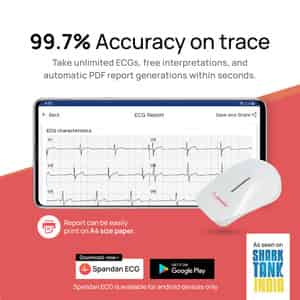 Buy SPANDAN PORTABLE 12- LEAD ECG DEVICE | ECG IN 10 SECONDS | POCKET ...