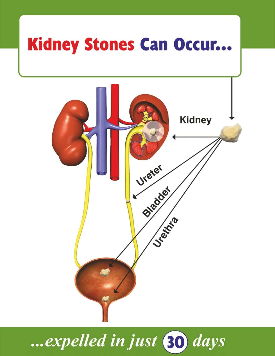 Buy STONEX CAPSULE SINGLE SOLUTION FOR STONES - 10 X 10 Online & Get ...