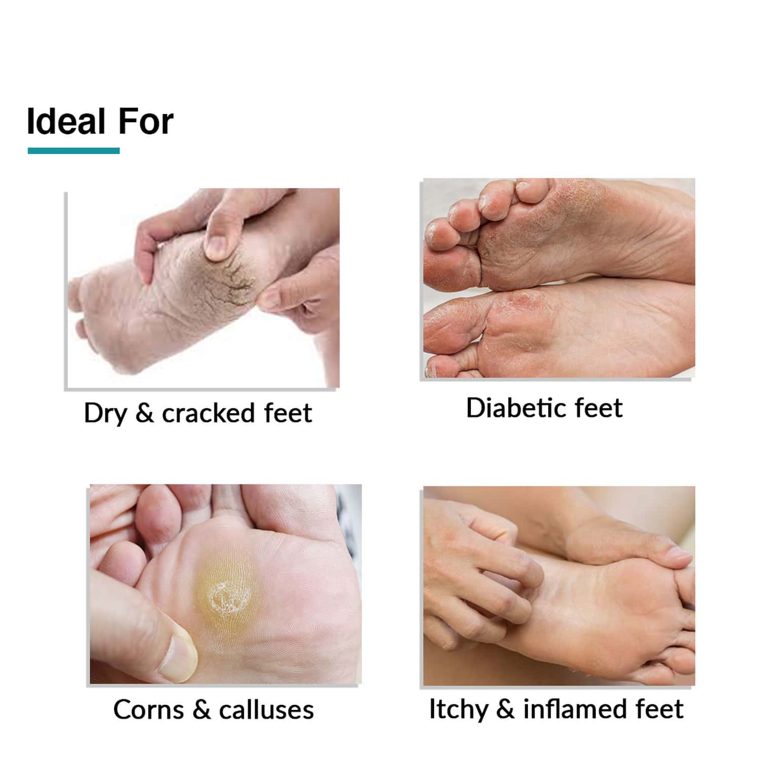 Buy FIXDERMA HEEL REPAIR FOOBETIK FOOT CREAM FOR NORMAL DIABETIC FOOT ...