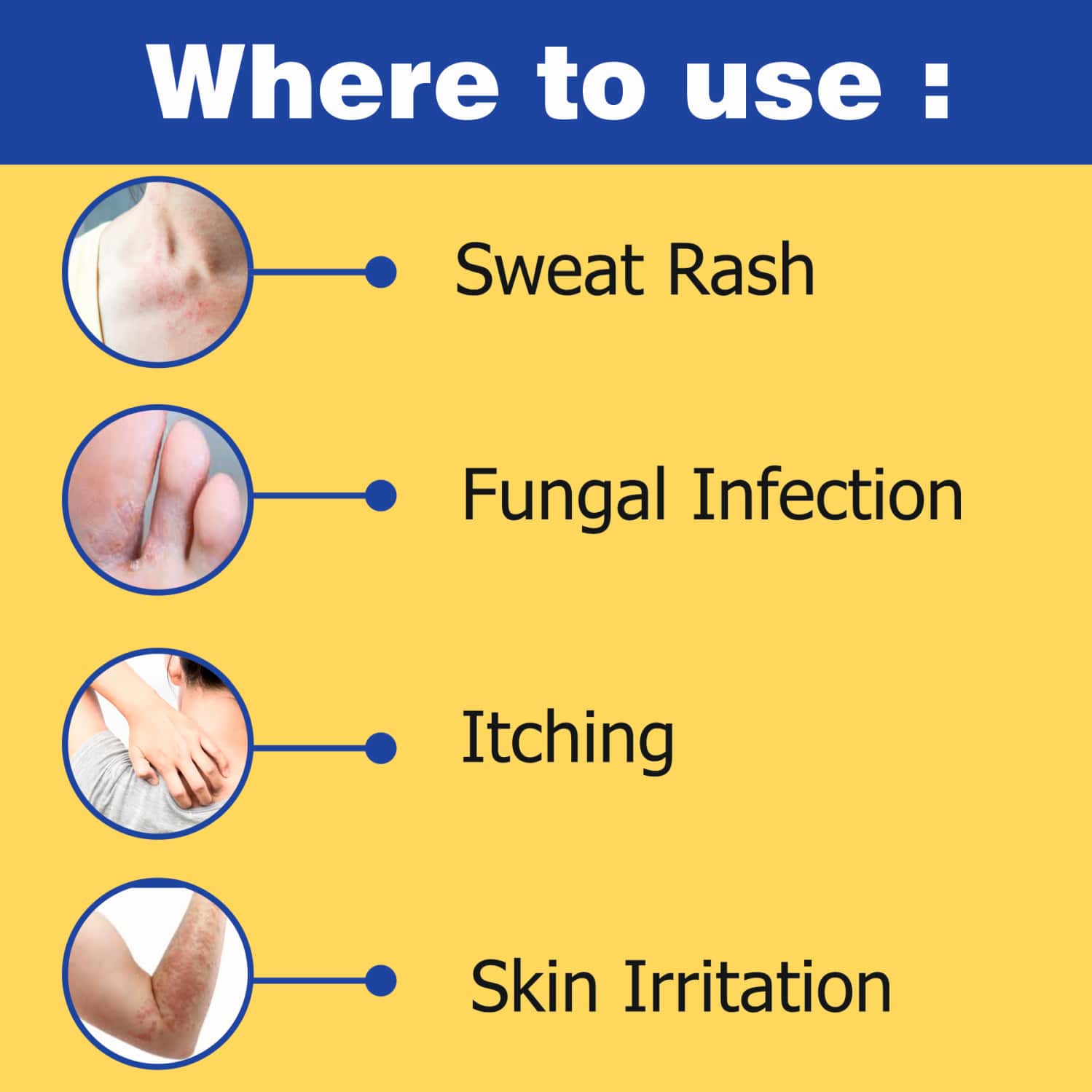 Buy FUNGRIS CLOTRIMAZOLE 1 % ANTI FUNGAL DUSTING POWDER 100 GMS PACK OF ...