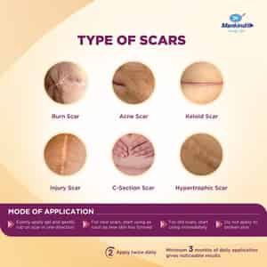 Buy MANKIND SCAREND SILICONE GEL | SCAR REMOVAL | BURN | STRETCH | ACNE ...