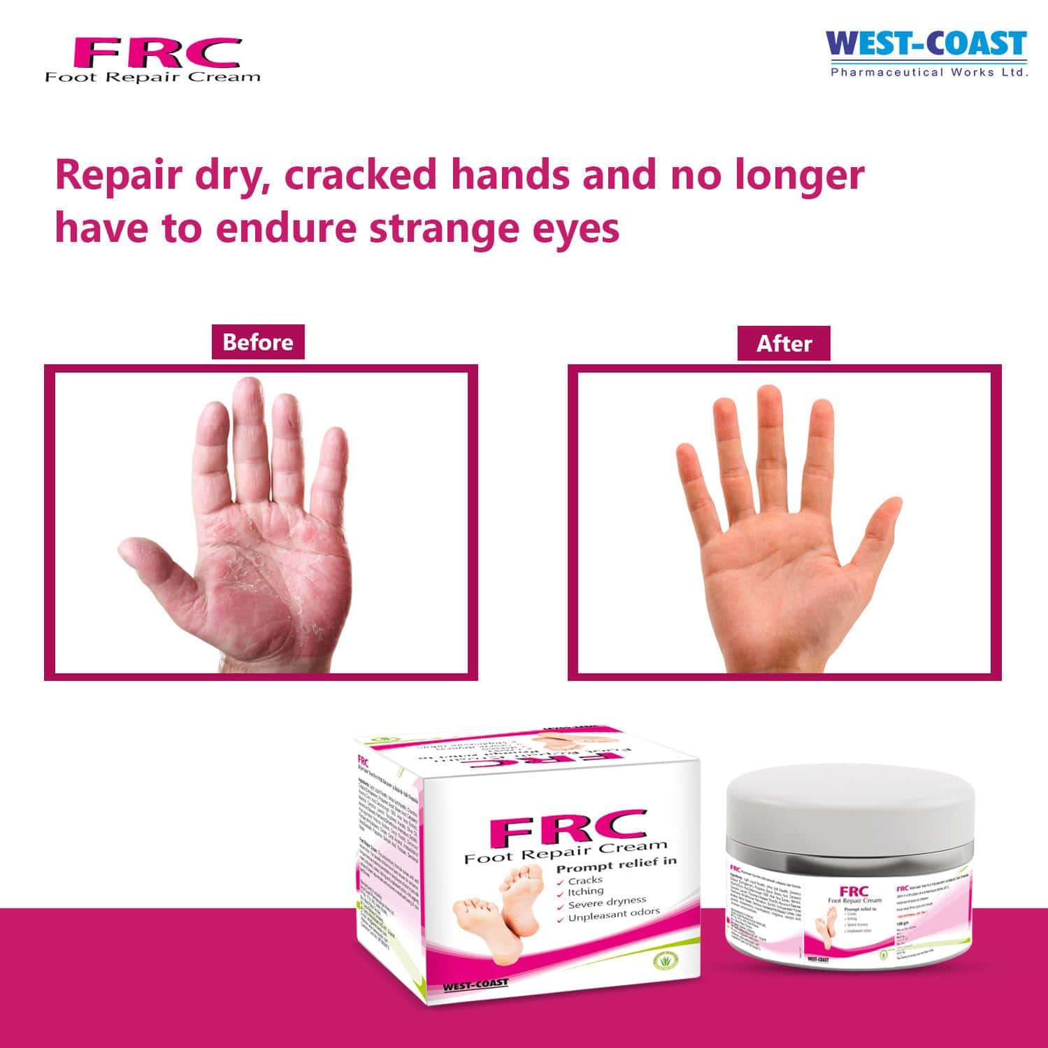 Buy WEST COAST FRC FOOT REPAIR CREAM - PACK OF 2 - 100 GM Online & Get ...