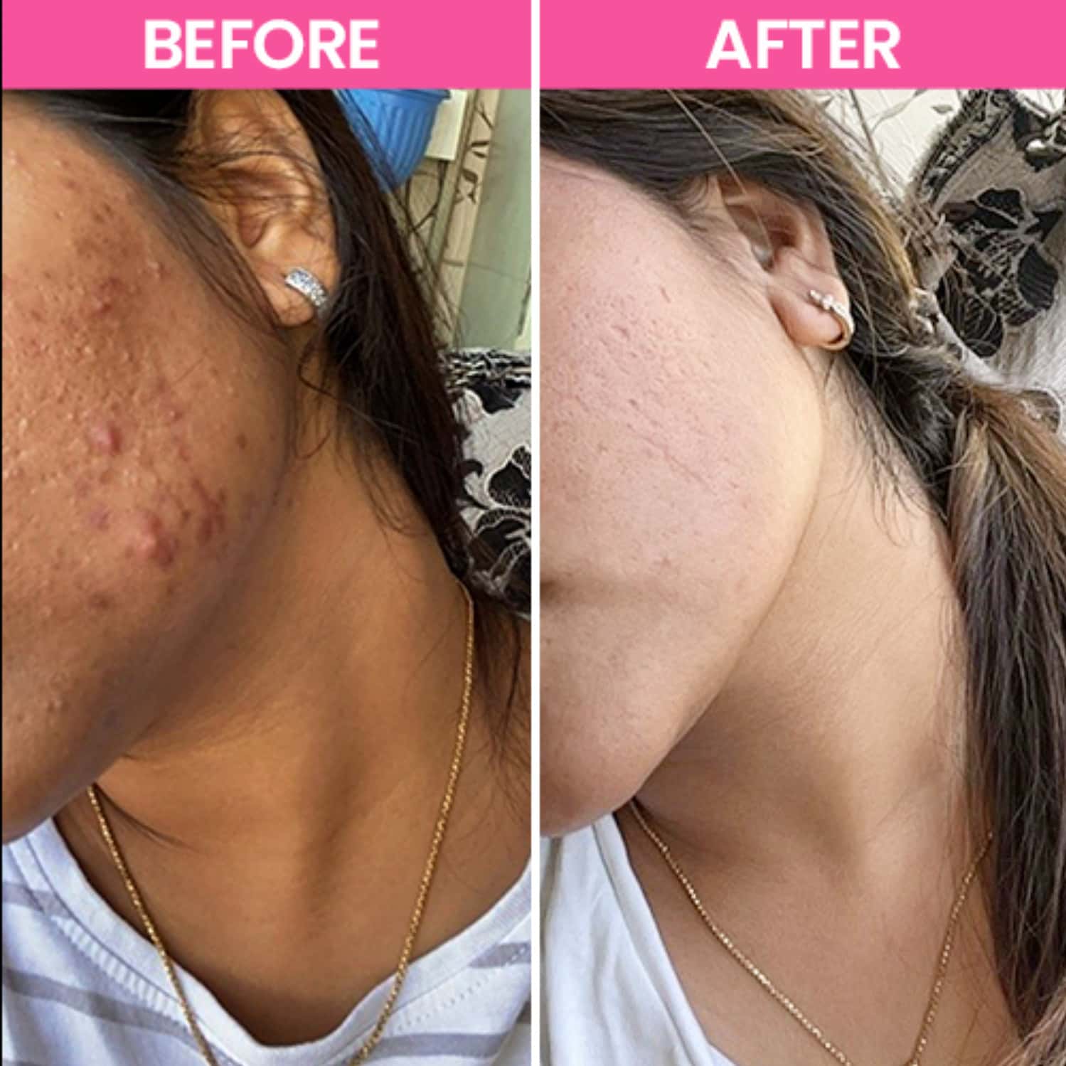 Buy CHICNUTRIX GLOW - GLUTATHIONE EFFERVESCENT TABLETS FOR WOMEN ...