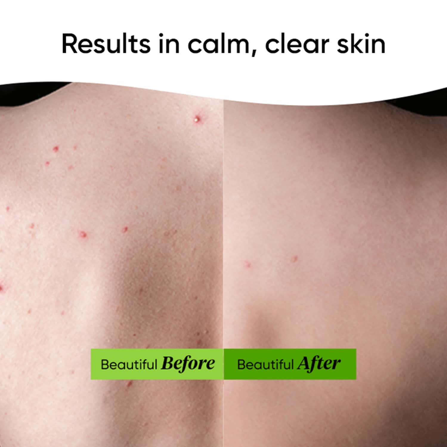 Buy DOT & KEY CICA CALMING BACK & BODY SKIN CLARIFYING SPRAY, 150ML ...