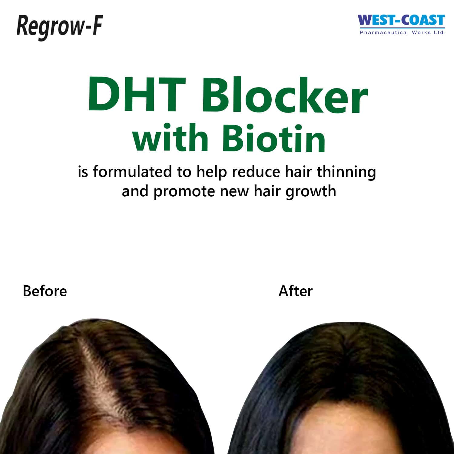 Buy WEST COAST REGROW F TOPICAL SOLUTION Online & Get Upto 60% OFF at ...