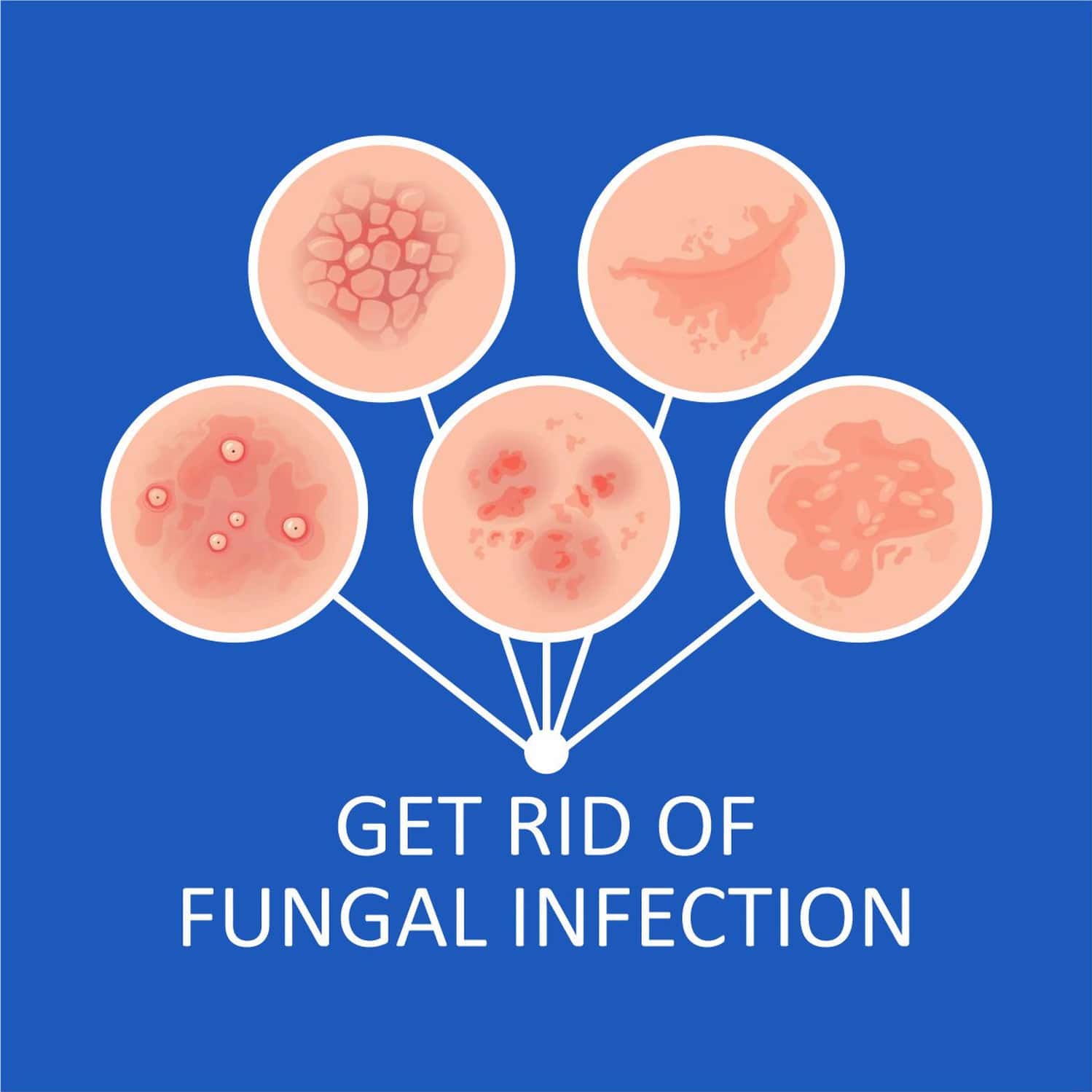 Buy CLOTREX DUSTING POWDER (100G) Online & Get Upto 60% OFF at PharmEasy